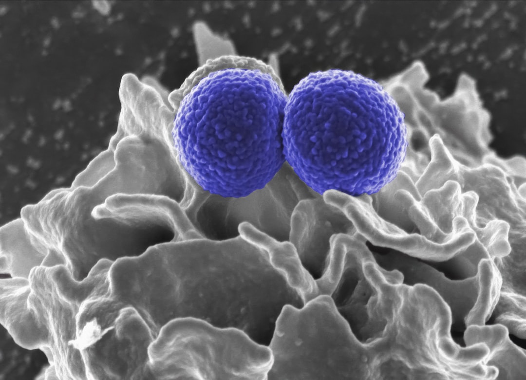 Toledo's History of Microcystin Algae Blooms